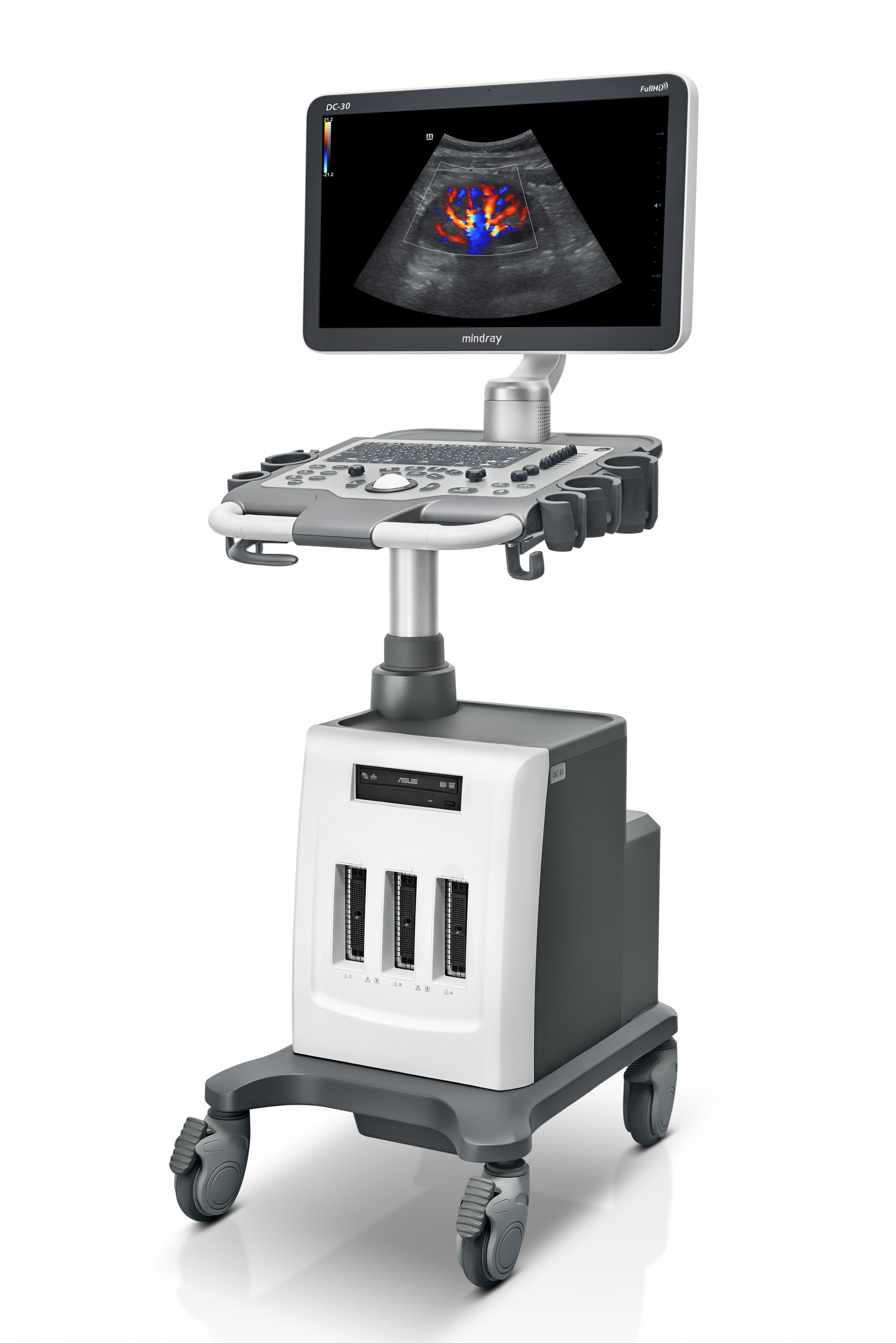 Mindray DC-30 with Full HD | MTG Rehrmann